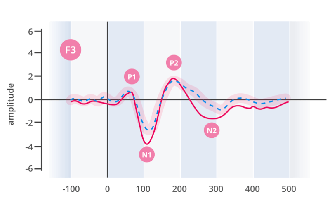 BrainView - BrainView